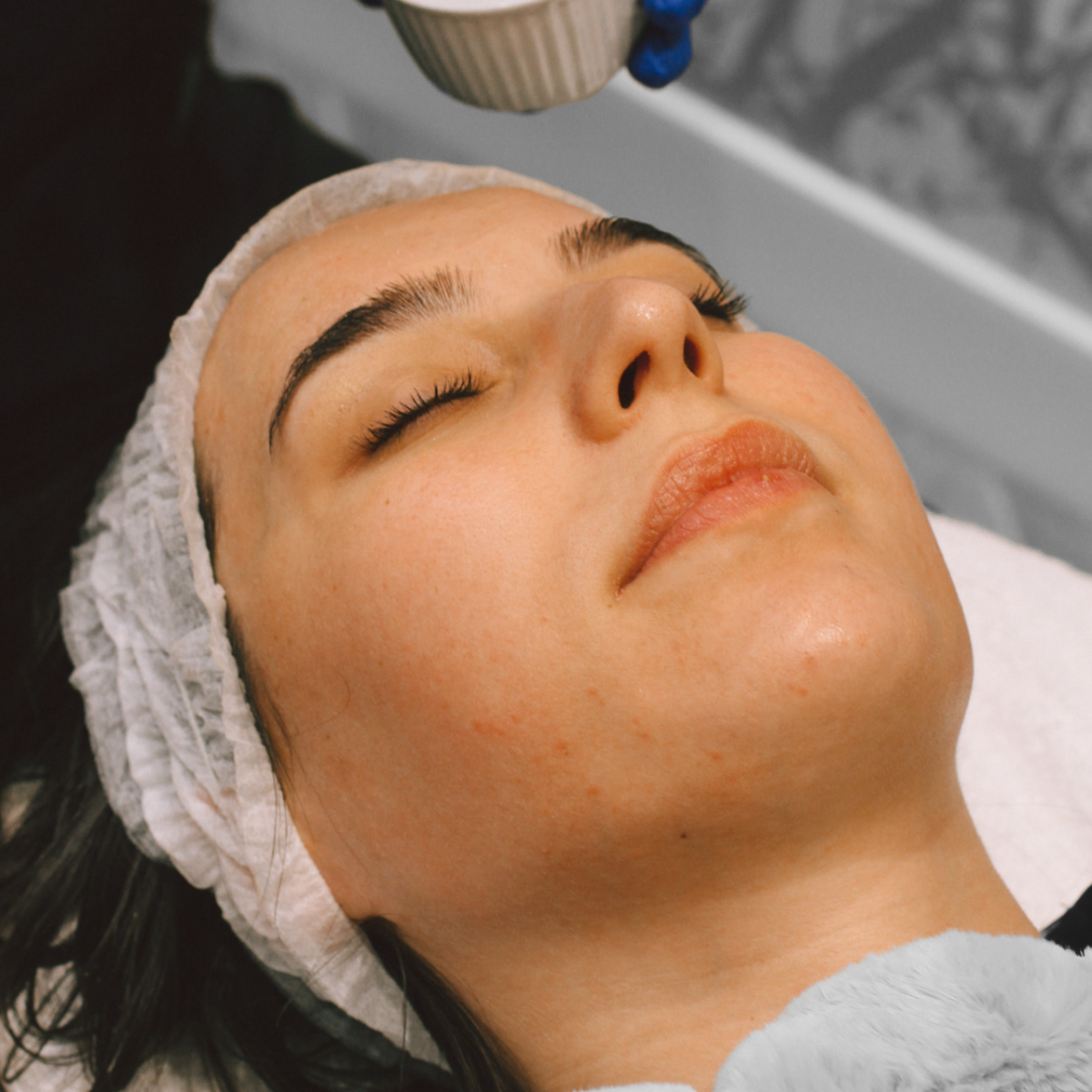 Skin Conditions During Pregnancy | Rejuvenation Dermatology