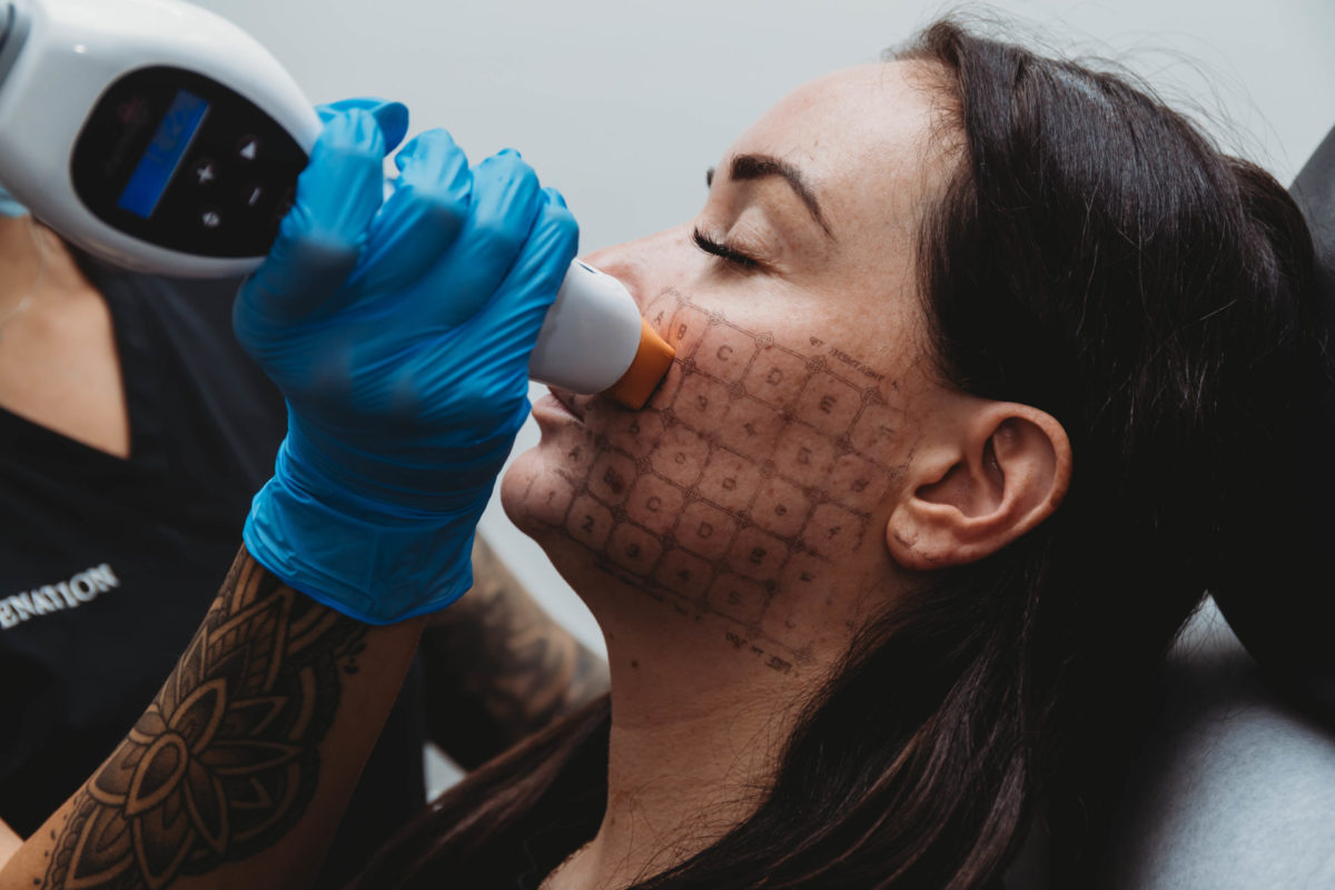 Thermage Calgary, Edmonton & Burnaby | Rejuvenation Dermatology