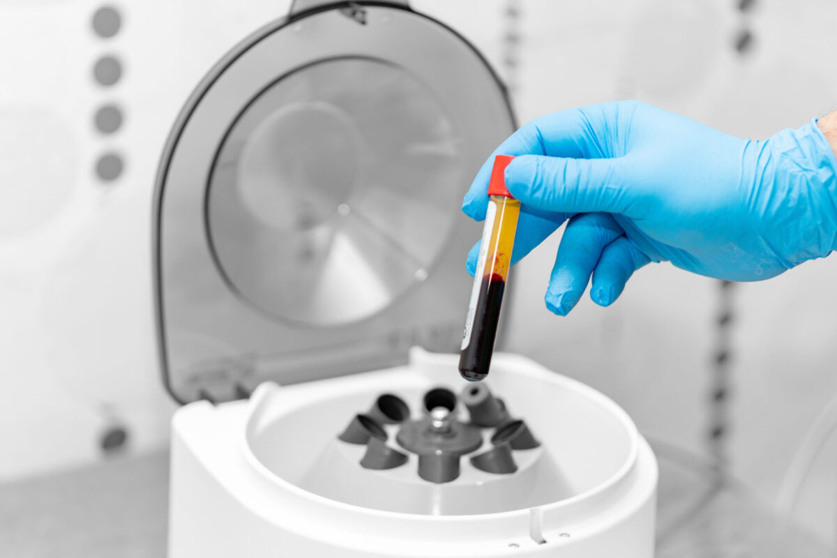 PRP - Platelet-Rich Plasma - Rejuvenation Dermatology