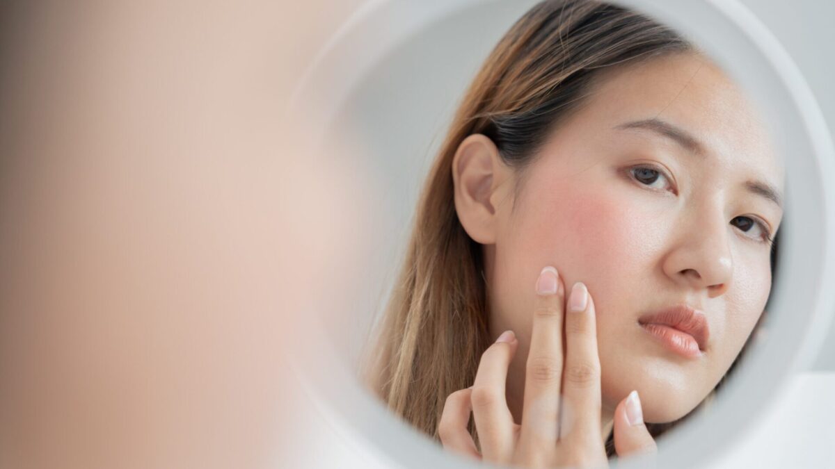 Rosacea Relief: Dermatologist-Approved Solutions - Rejuvenation Dermatology